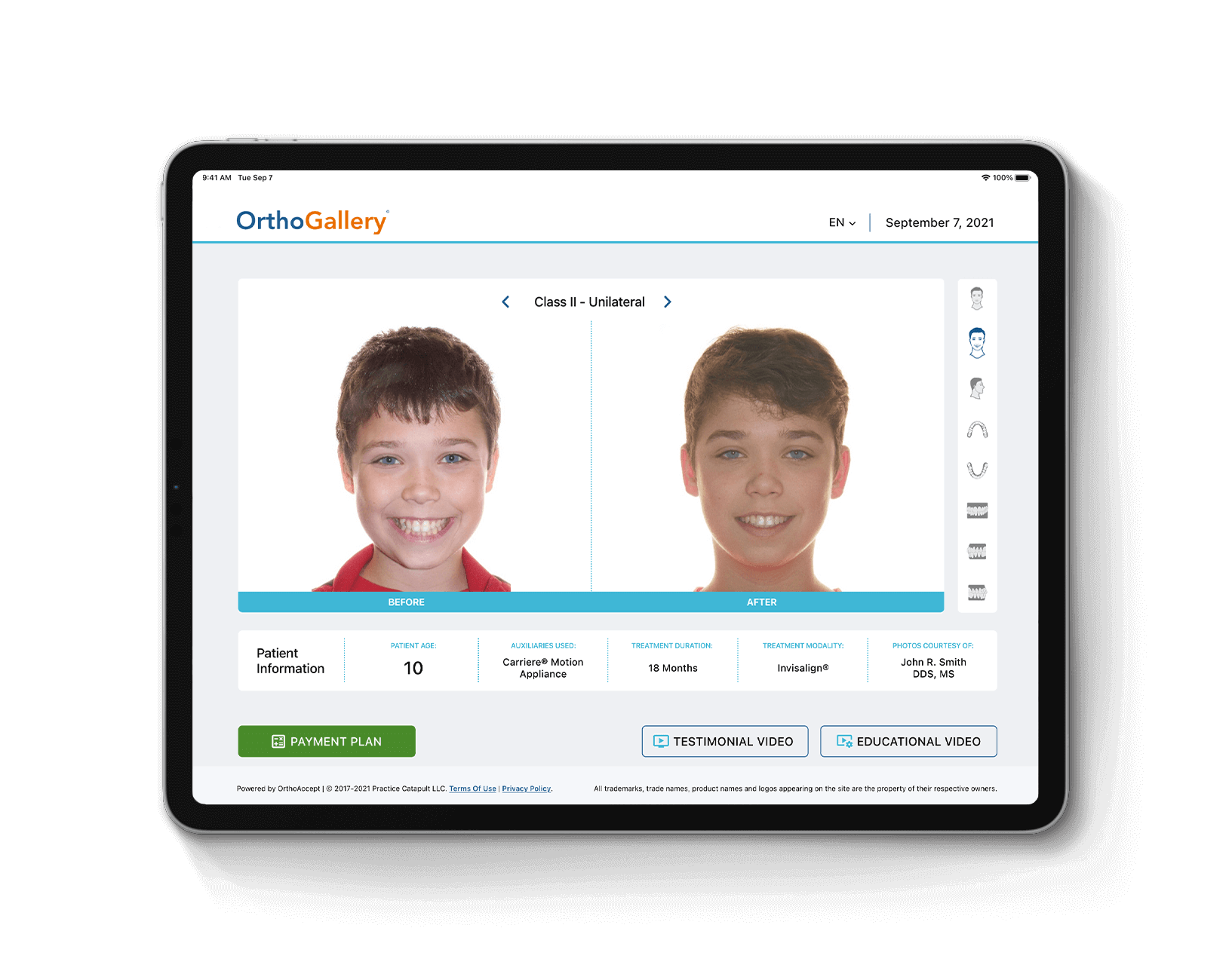 The Ultimate Orthodontic Conversion Platform | OrthoCatapult